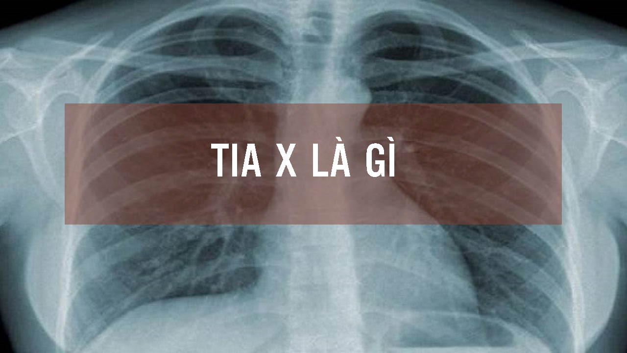 Tia X là gì? Tính chất và ứng dụng